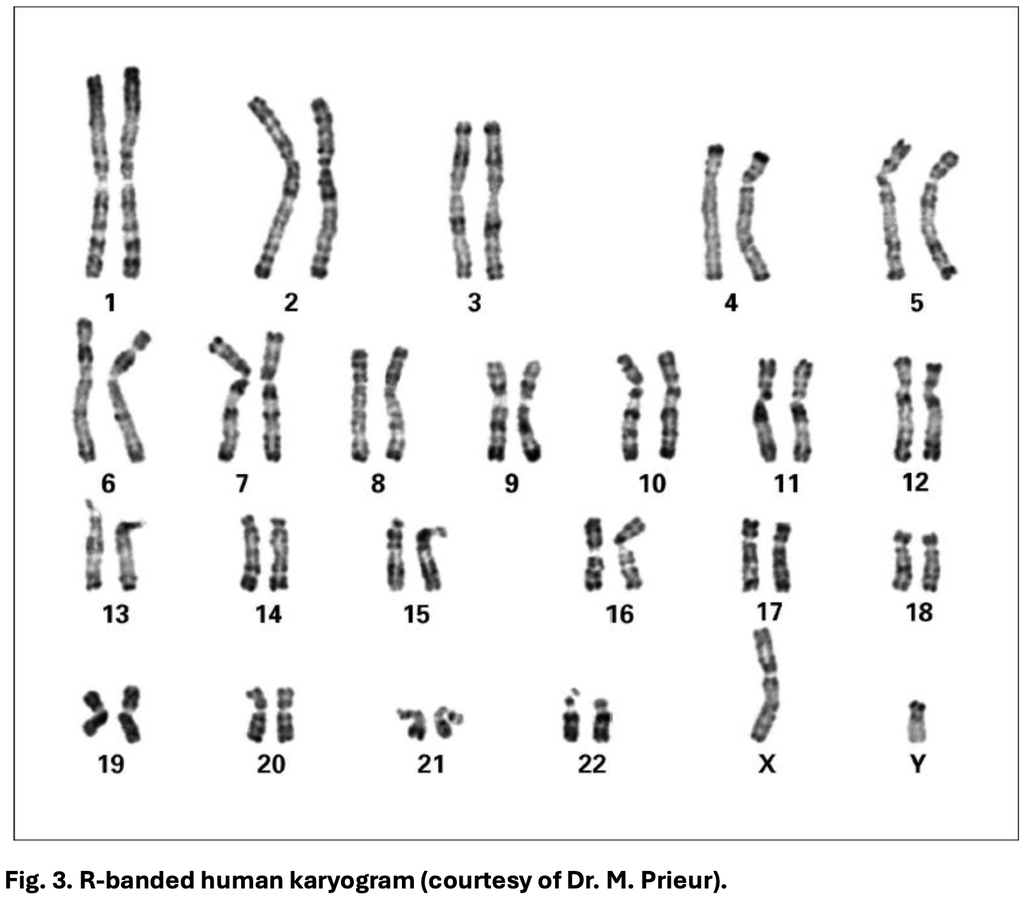 Types of Chromosome Banding – The Barcode Explained - Gene Commons
